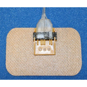 Synapse Biomedical Synapse Neurx Diaphragm Pacing System, Connector ...