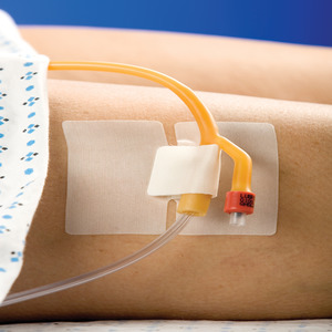 CATH-SECURE Multi-Purpose Tube Holder 2-1/2 Inch Tab & 3 x 1-3/4 Inch ...