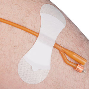 Tidi Products Grip-Lok Securement Device for Large Universal Catheter ...