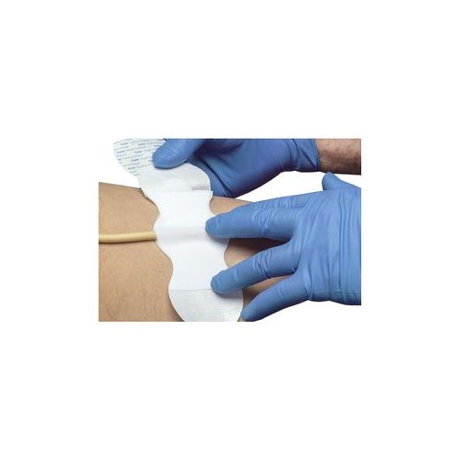 Dale Medical Products Inc Hold-n-Place General Purpose Securement ...