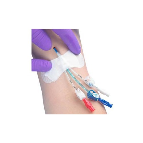 Tidi Products Grip-Lok Securement Device for Universal PICC Catheter, 3 ...